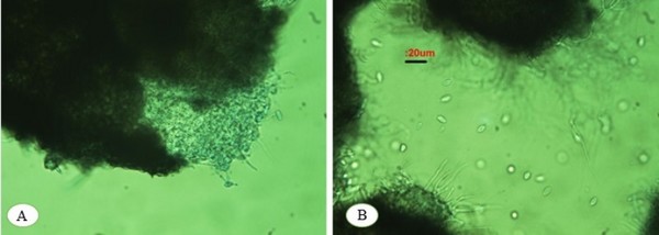 Iran: Phyllosticta capitalensis causing leaf spots on ornamental ...