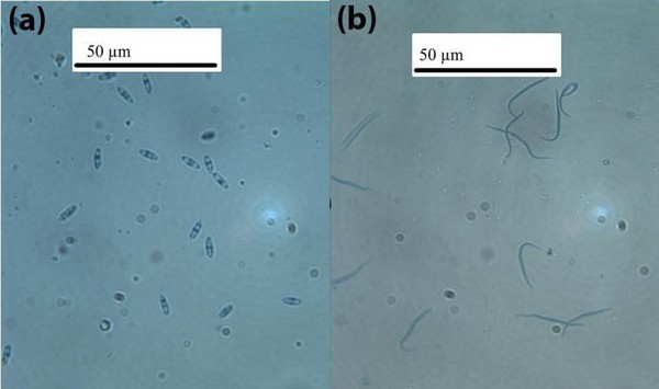 Diaporthe foeniculina causing yellowing and dieback on Ficus benjamina